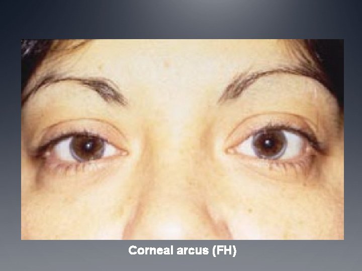 Objectives Lipid physiology story Common primary and secondary