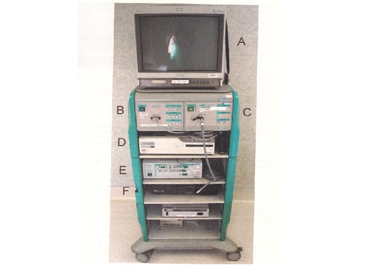 Endoscopy in Gynecology Dr Yashodhara Pradeep Prof Ob