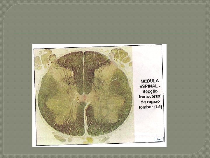 Anatomia do Sistema Nervoso Central Rafael Coutinho Membro