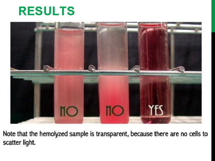 Hemolysing Agents Detection of Blood Blood Hemolysis Hemolysis