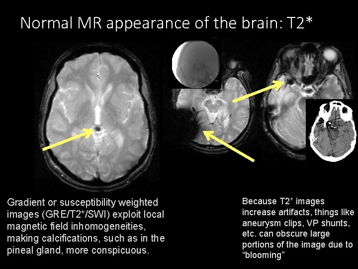 Radiology Pathology Brain Pathology Before You Begin This