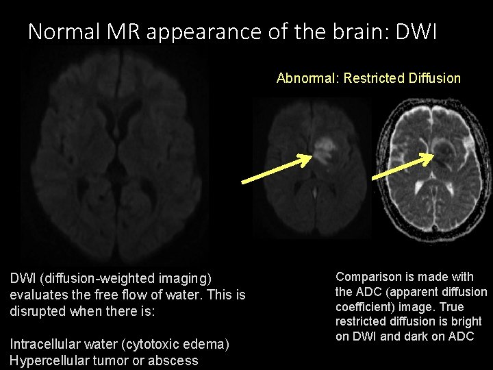 Radiology Pathology Brain Pathology Before You Begin This
