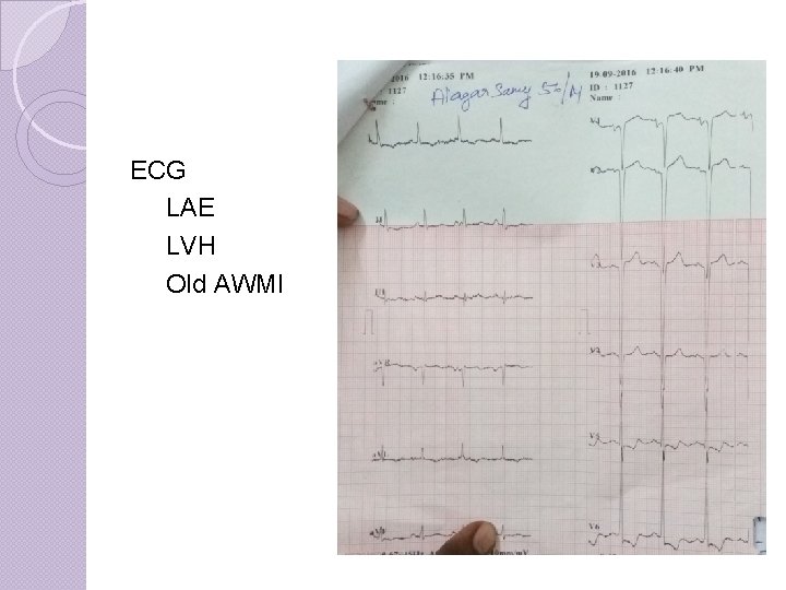 AN INTERSTING CASE OF HYPERLIPIDEMIA SECOND MEDICAL UNIT