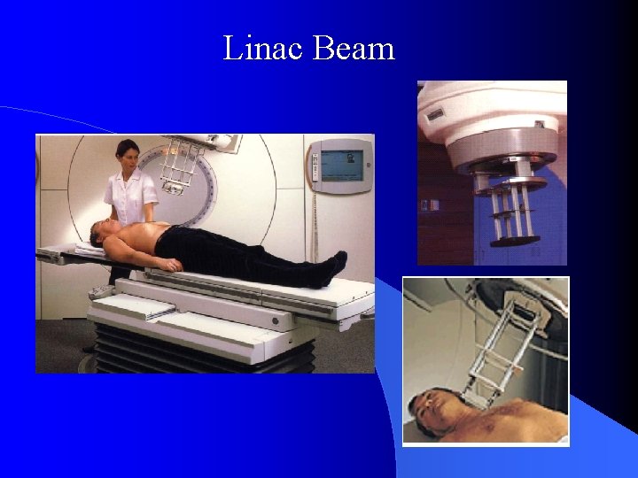 Linac Beam Treatment Head Components of the dose