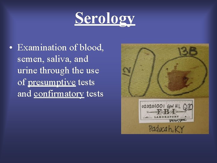 SEROLOGY SEROLOGY The science of body fluid identification