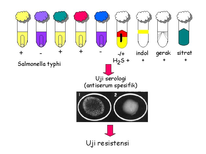 Departemen Mikrobiologi FKUKRIDA ENTEROBACTERIACEAE Peragi laktosa ...