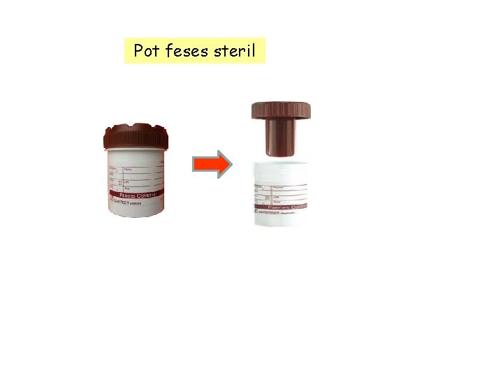 Departemen Mikrobiologi FKUKRIDA ENTEROBACTERIACEAE Peragi laktosa ...