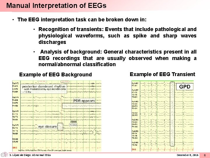 Automated Identification of Abnormal Adult EEGs A Thesis