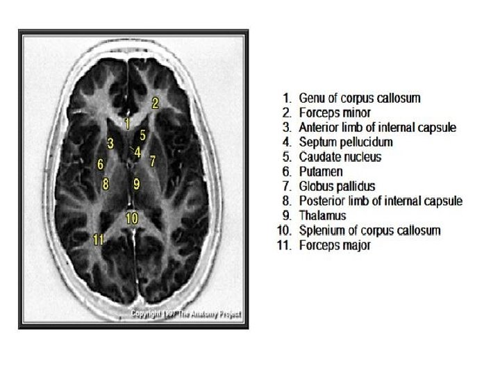 WHIT MATTER OF THE CERBRUM BY PROF SAEED