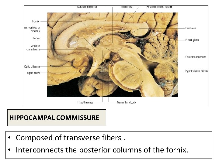 WHIT MATTER OF THE CERBRUM BY PROF SAEED