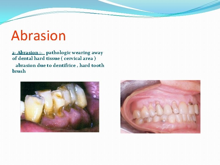 Teeth examination Prof Magdy K Hamam Prof of