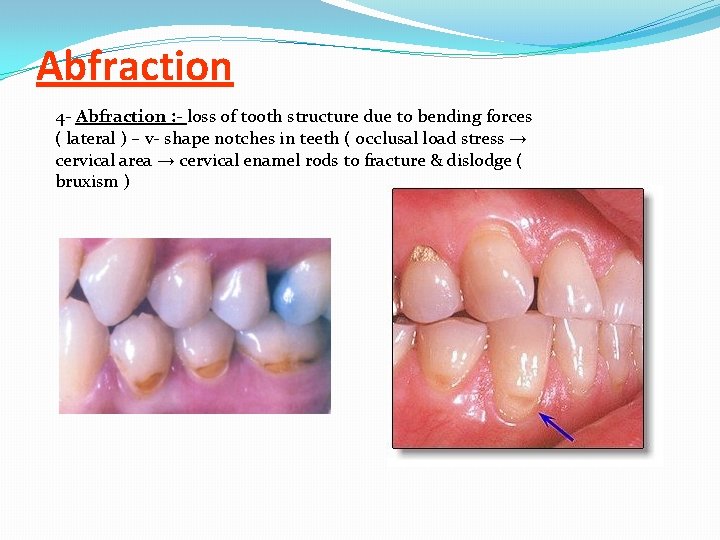 Teeth examination Prof Magdy K Hamam Prof of