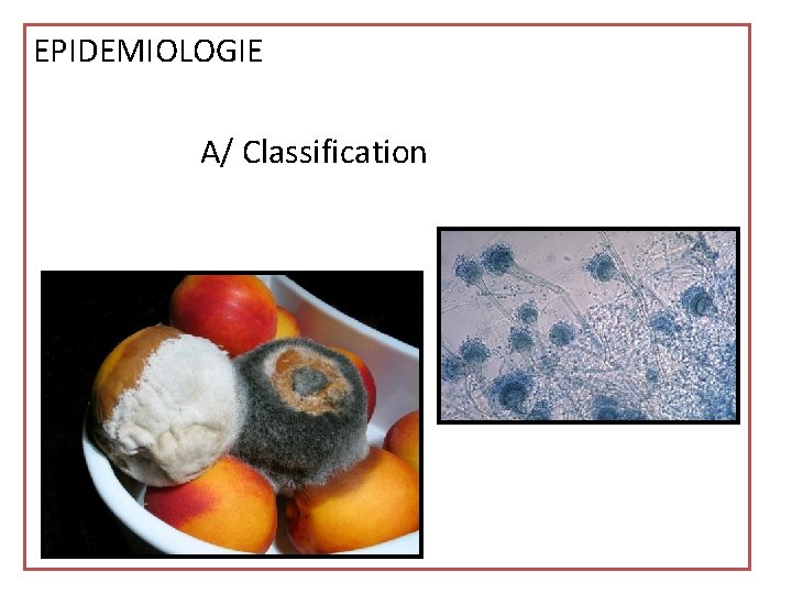 Aspergilloses Dr w Beldjoudi 2 O 142015 INTRODUCTION