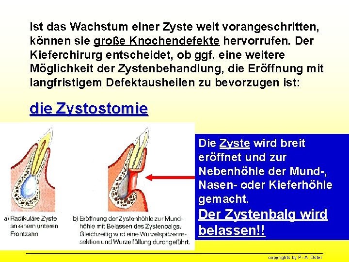 Lernfeld VIII Chirurgische Behandlungen begleiten Teil 3 Zysten