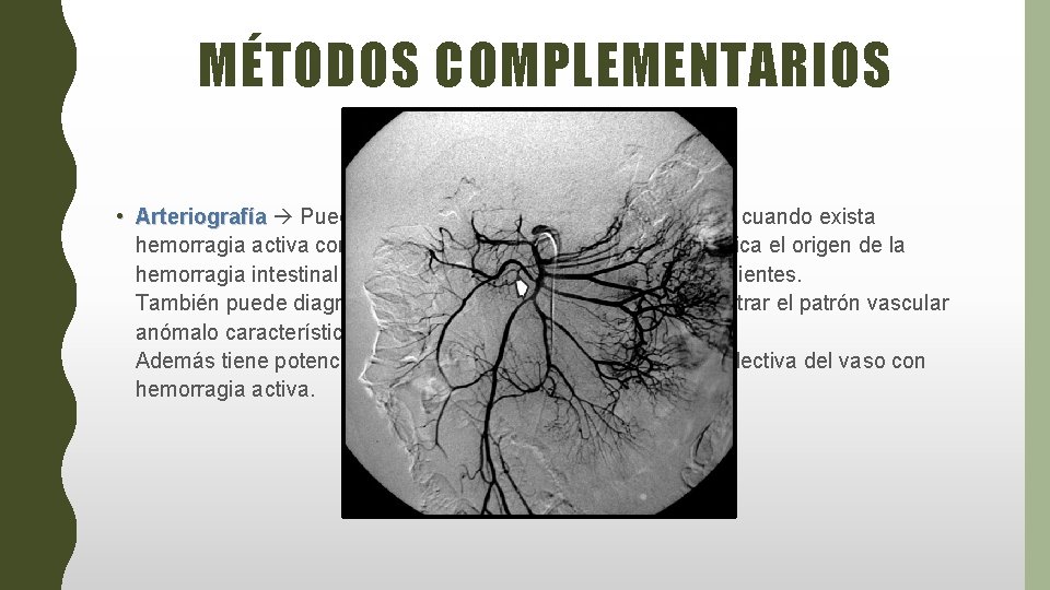 HEMORRAGIA DIGESTIVA BAJA C A T E D
