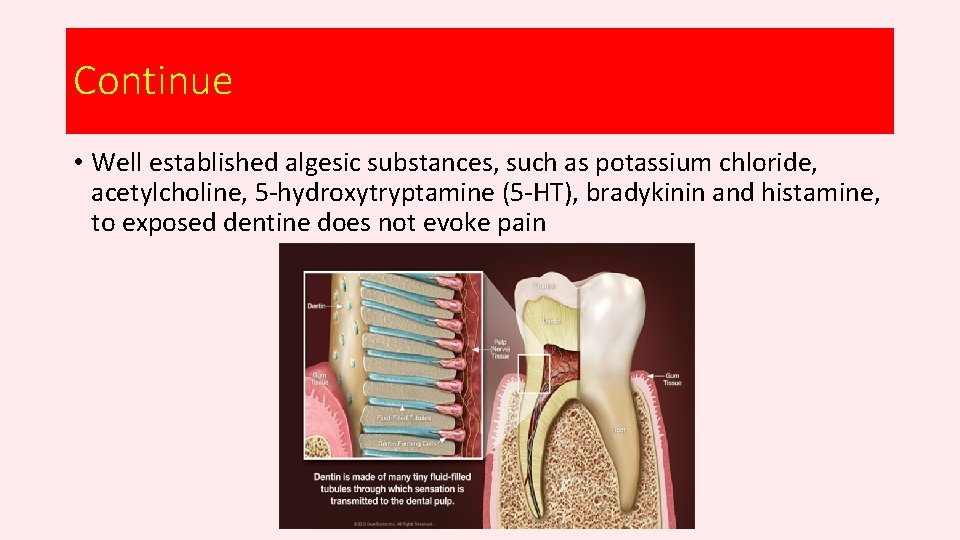 Acute orofacial pain Mohammad Shooriabi Assistant Professor Department