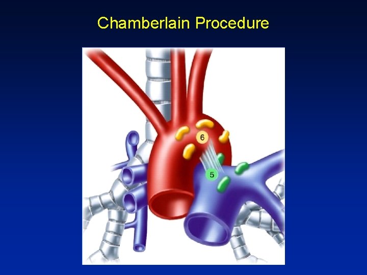 The Nuances of Staging Lung Cancer Gerard A