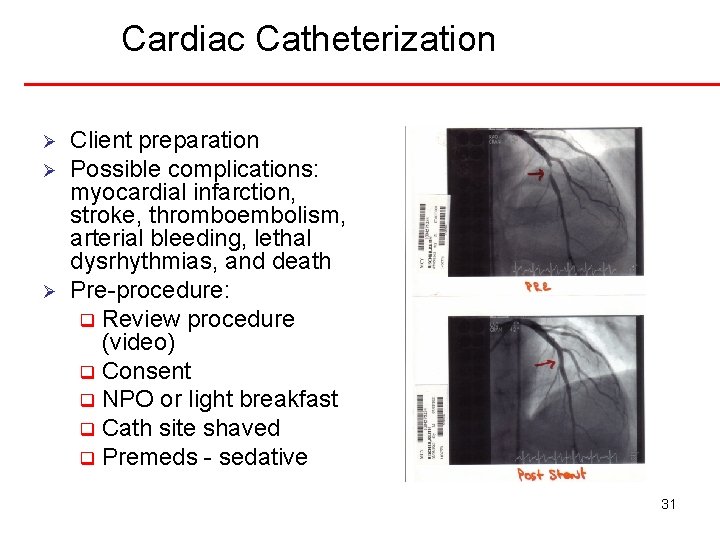 Nursing Assessment of the Cardiovascular System Keith Rischer