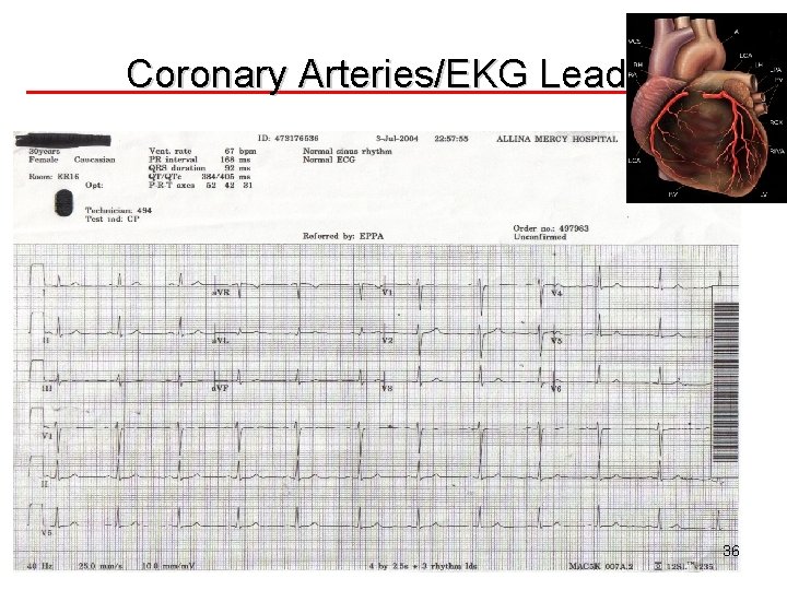 Nursing Assessment of the Cardiovascular System Keith Rischer