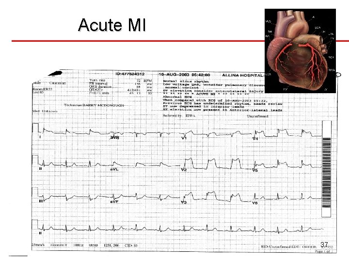 Nursing Assessment of the Cardiovascular System Keith Rischer