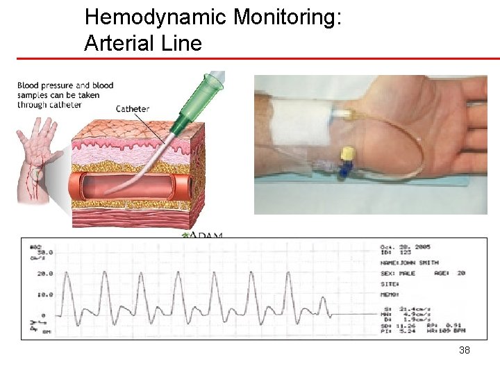 Nursing Assessment of the Cardiovascular System Keith Rischer
