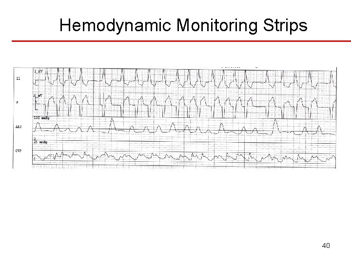 Nursing Assessment of the Cardiovascular System Keith Rischer
