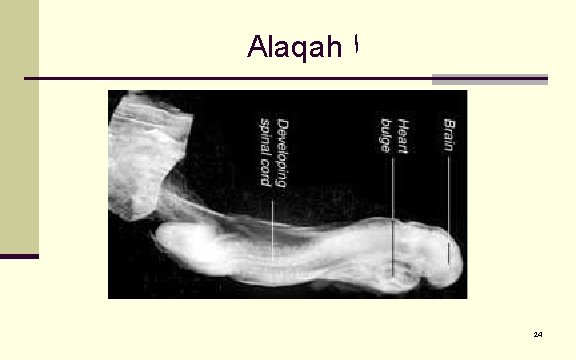 Quran and Baby Formation By Dr Sharif Kaf