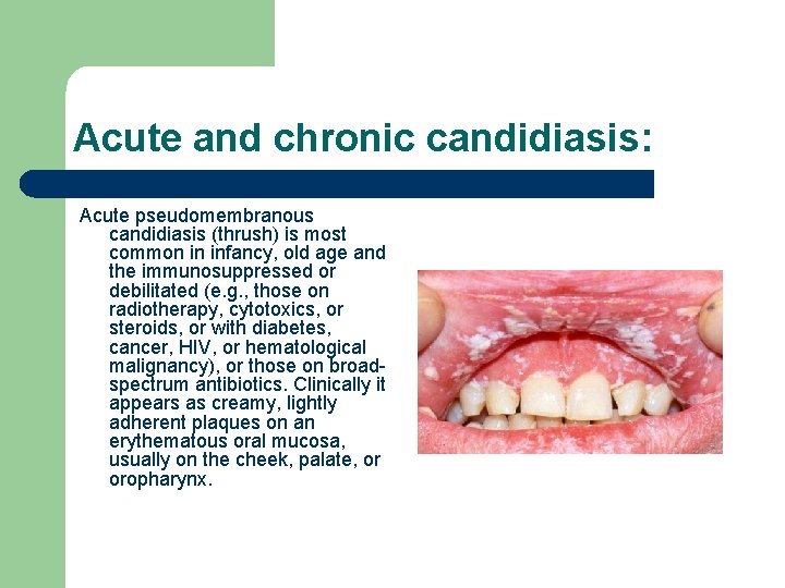 THERAPEUTIC DENTISTRY 5 TH YEAR STUDENTS lecture 1