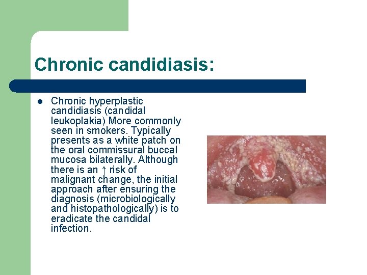THERAPEUTIC DENTISTRY 5 TH YEAR STUDENTS lecture 1