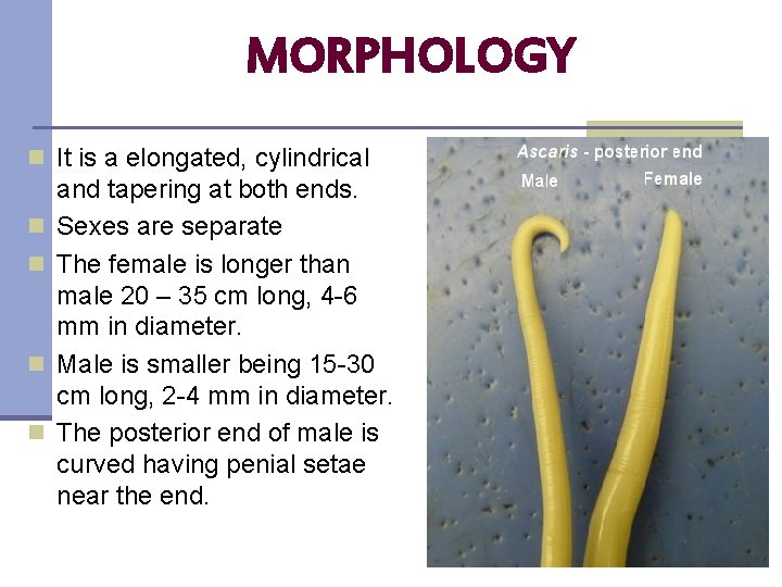 ASCARIASIS A COMMON ROUND WORM DISEASE BY DR