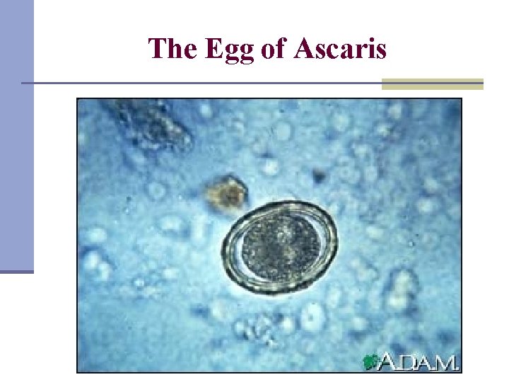 ASCARIASIS A COMMON ROUND WORM DISEASE BY DR