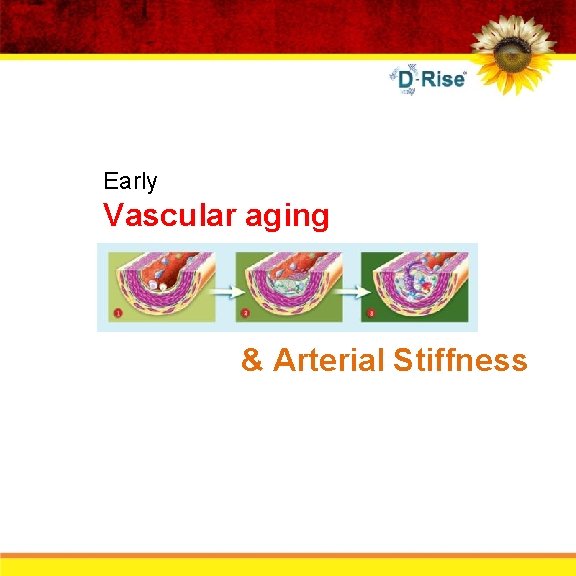 Early Vascular aging Arterial Stiffness Normal vascular aging