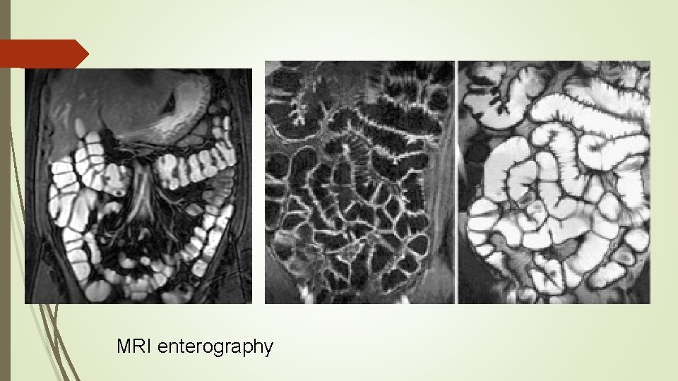 GIT Radiological investigations and anatomy Dr Sultan Alharbi