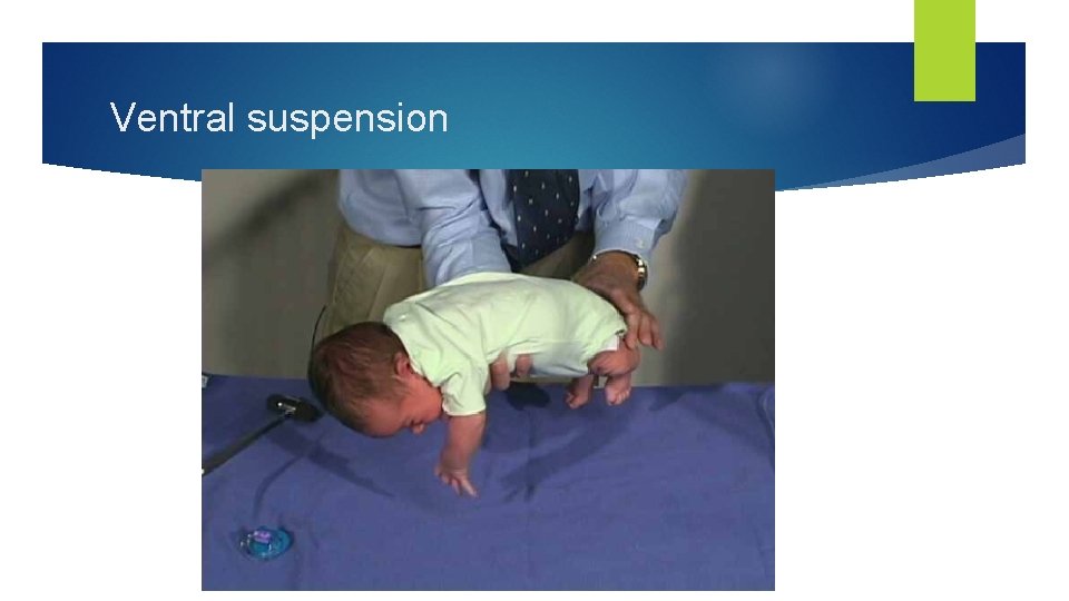 Developmental Assessment DR REDAB ALGHAWANMEH Introduction Principles of