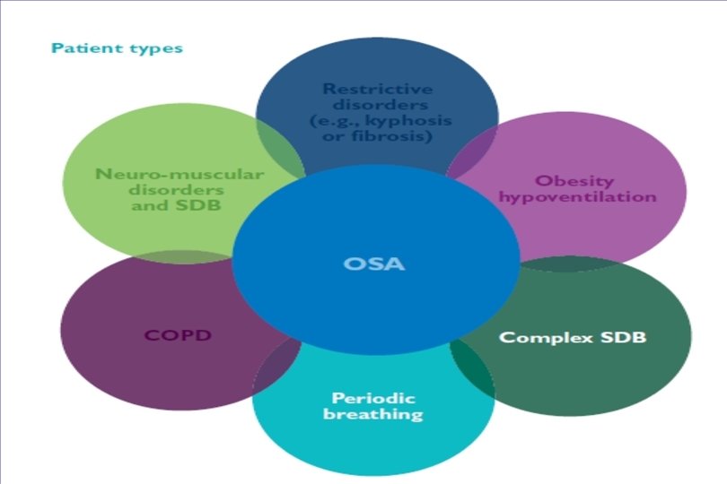 Positive Airway Pressure For OSAS BY AHMAD YOUNES