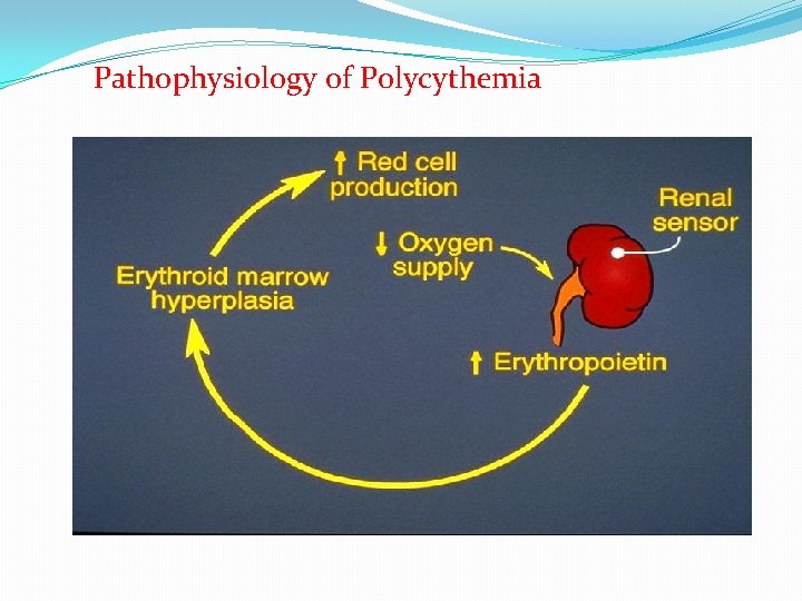 Lecture 4 Polycythemia causes clinical signs and labortary