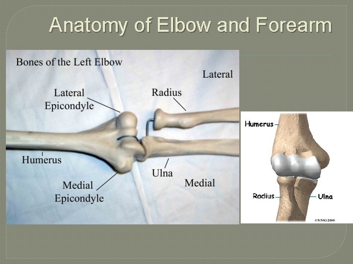 The Elbow and Forearm Bones Humerus Major Upper