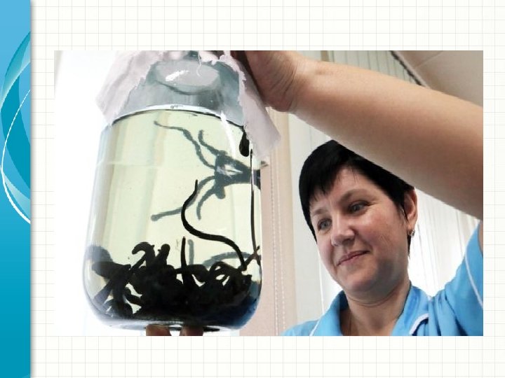 NURSES EXPERIENCES OF LEECH THERAPY IN PLASTIC AND