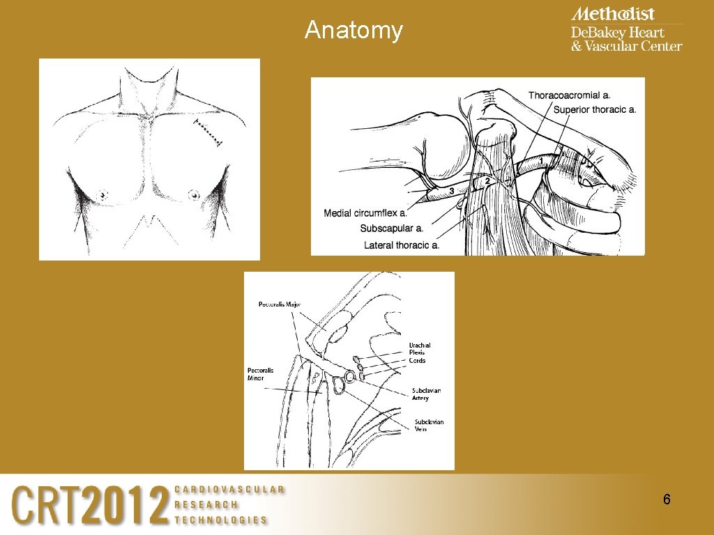 Technical Aspects of Subclavian and Direct Aortic Access