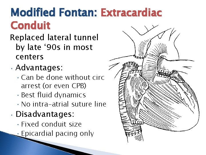 Congenital Heart Disease Outcome in Patients with Single