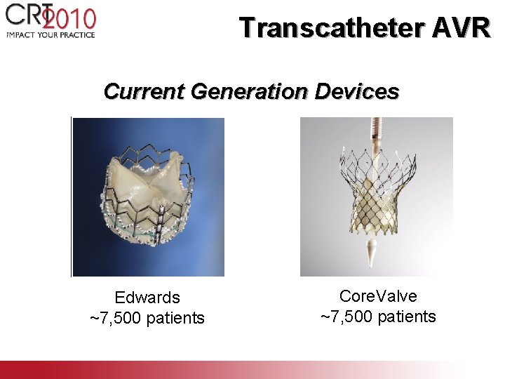 What You Need to Know About Percutaneous TAVI