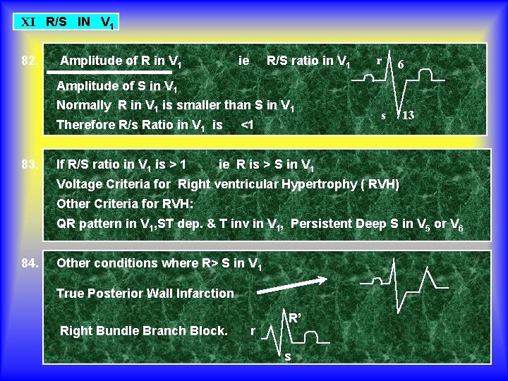 ECG IN 100 STEPS By Dr S Aswini