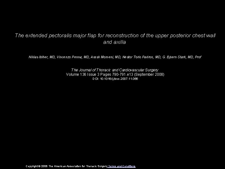 The extended pectoralis major flap for reconstruction of