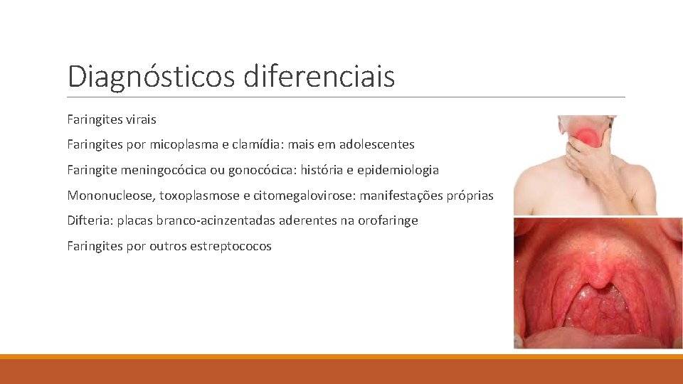 Faringoamigdalite estreptoccica aguda Internato em Pediatria Acadmica ...