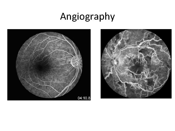 Review of anatomy physiology of the Retina Dr