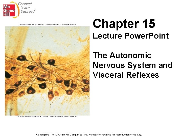 Chapter 15 Lecture Power Point The Autonomic Nervous