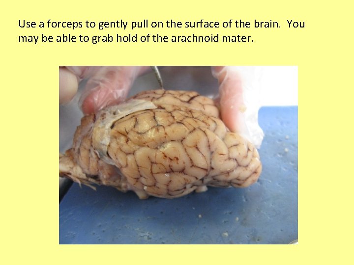 Brain Dissection How to perform a successful brain