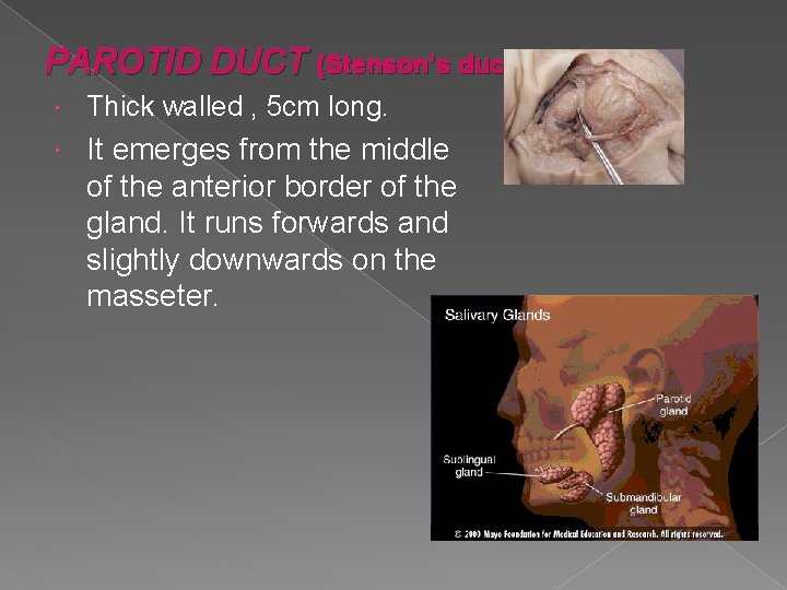 Parotid region It is a fascial lined space