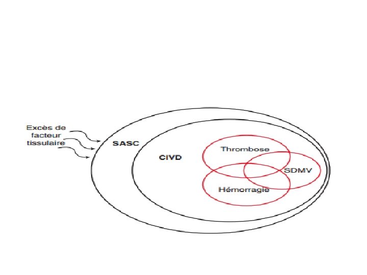 TROUBLES DE L HEMOSTASE CIVD Fibrinolyse PLAN DU
