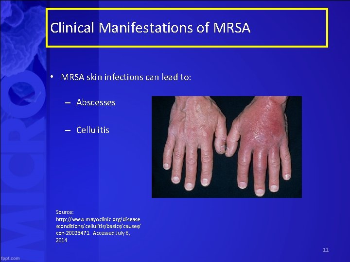 Session 1 Introduction to MDROs 1 Introduction to